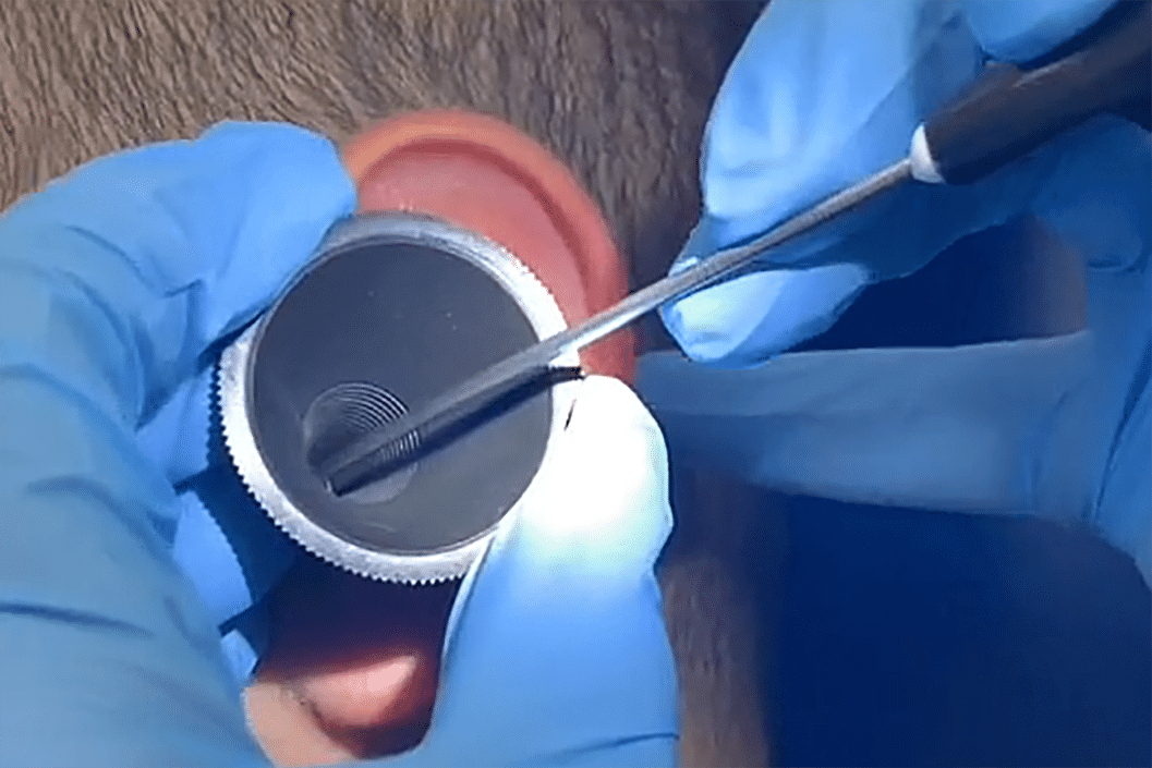 What is Ear Wax? - Veritas Hearing UK